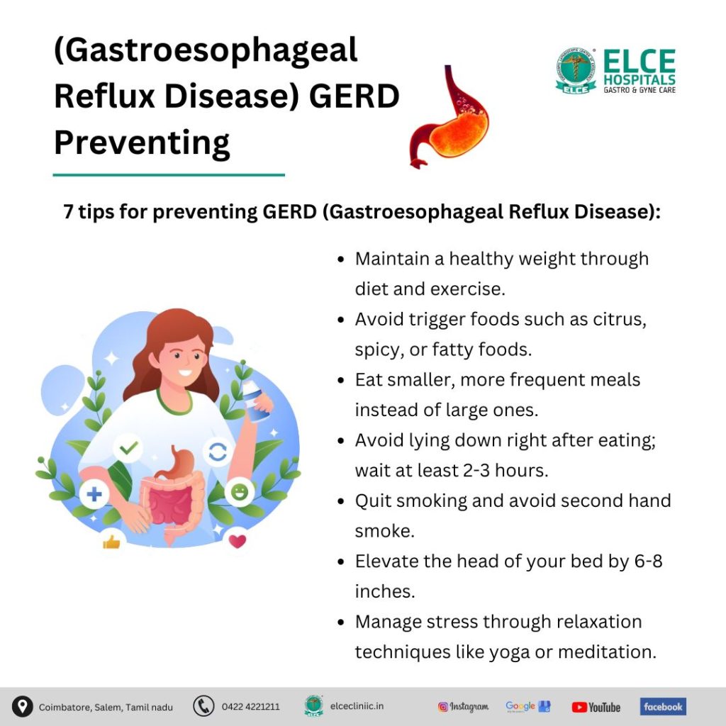 GERD Treatment | GERD Treatment In Coimbatore - Elce Clinic