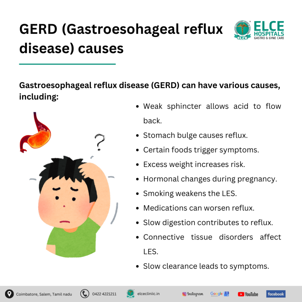 GERD Treatment | GERD Treatment In Coimbatore - Elce Clinic